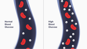 Diabetes FAQs and Answers to Your A1C Testing Questions
