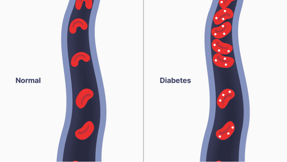 Diabetes FAQs and Answers to Your A1C Testing Questions